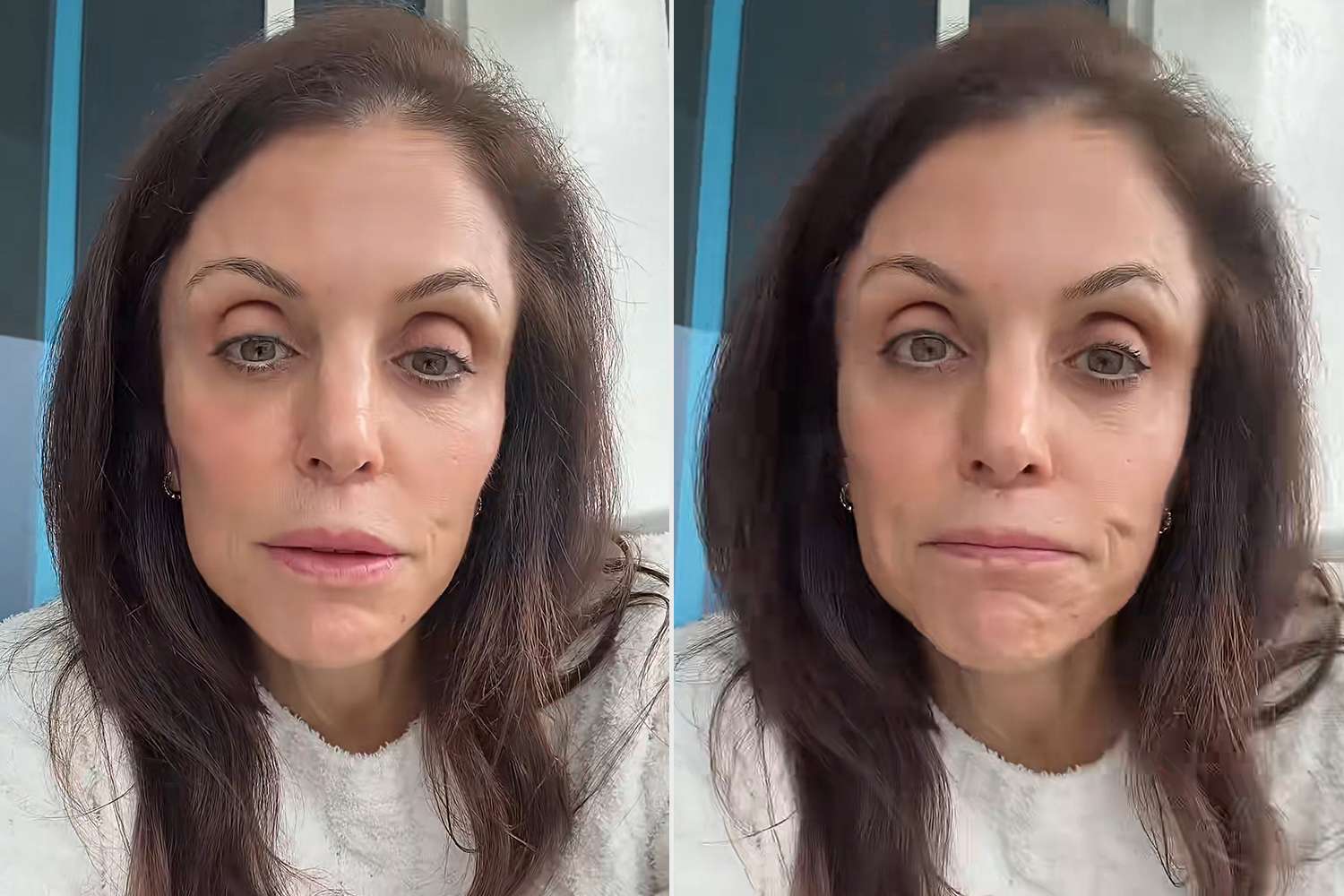 Bethenny Frankel says she has stage 2 chronic kidney disease: 'Go get ...