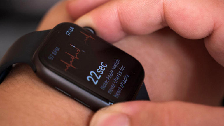 Apple Watch raises Afib diagnoses in high-risk patients