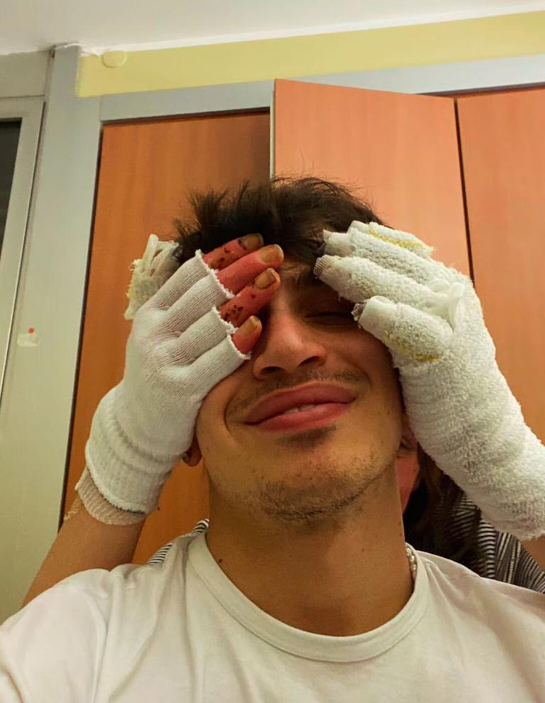 Eleonora Palmieri racconta Crans-Montana con le sue cicatrici