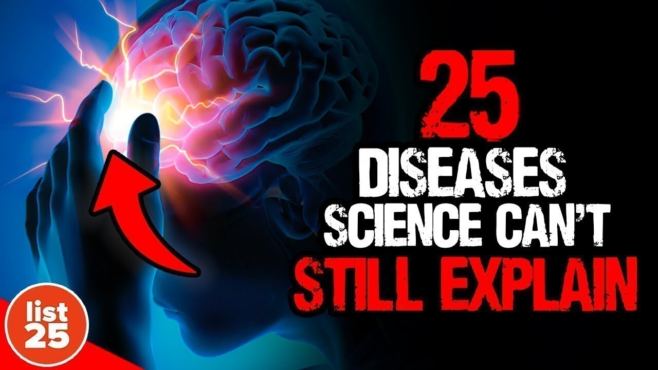 25 mind boggling diseases that science can't explain