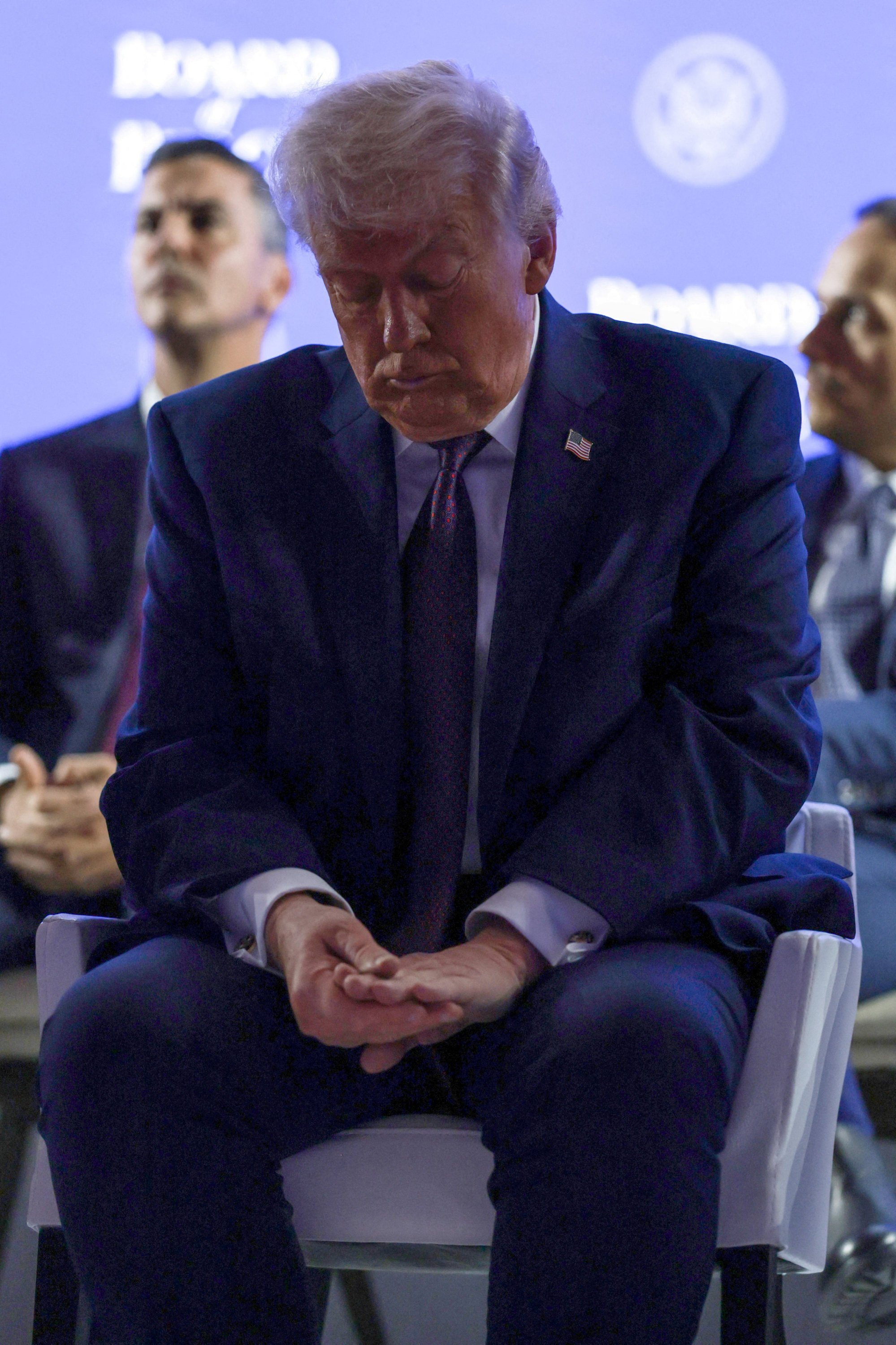 Trump blames table and aspirin after new bruise appears on his hand in ...