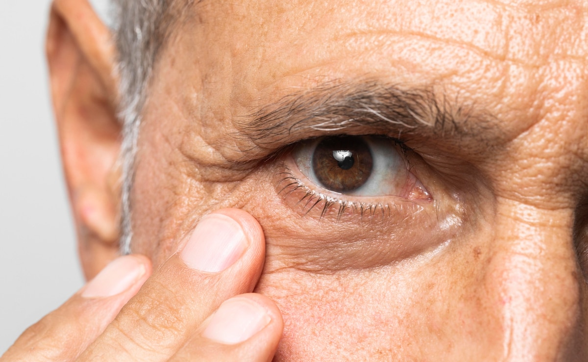 Can you have eye disease without symptoms? Understanding glaucoma