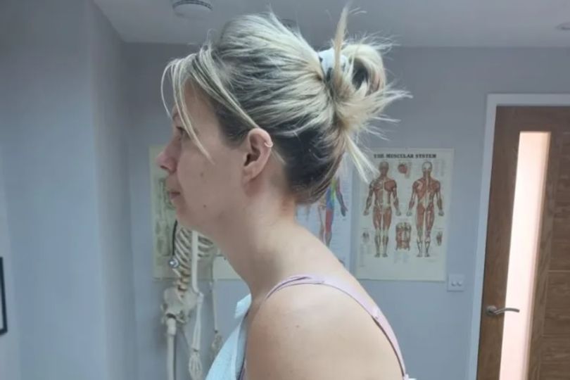 I'm on £1,300 benefits from DWP because 34GG breasts mean I can't work