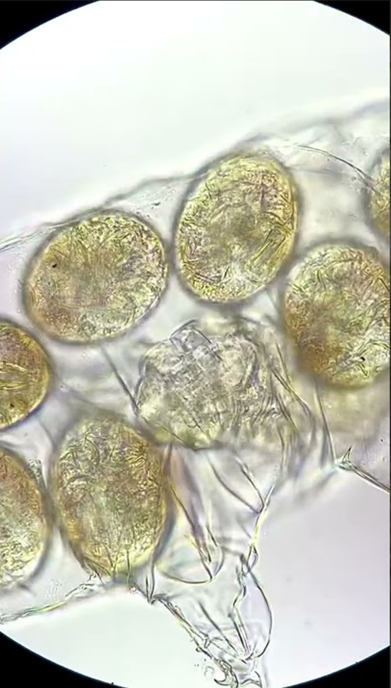 Tardigrades hatching under the microscope!