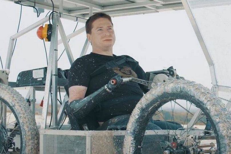 I thought I had flu - then my skin turned purple and my body went black