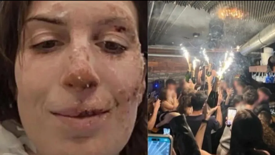 La vita è fatta di coraggio. Eleonora Palmieri si mostra col volto ferito