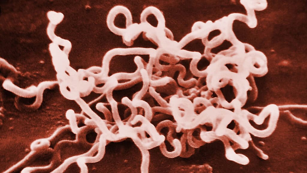 New discovery pushes the history of syphilis-like diseases back by ...