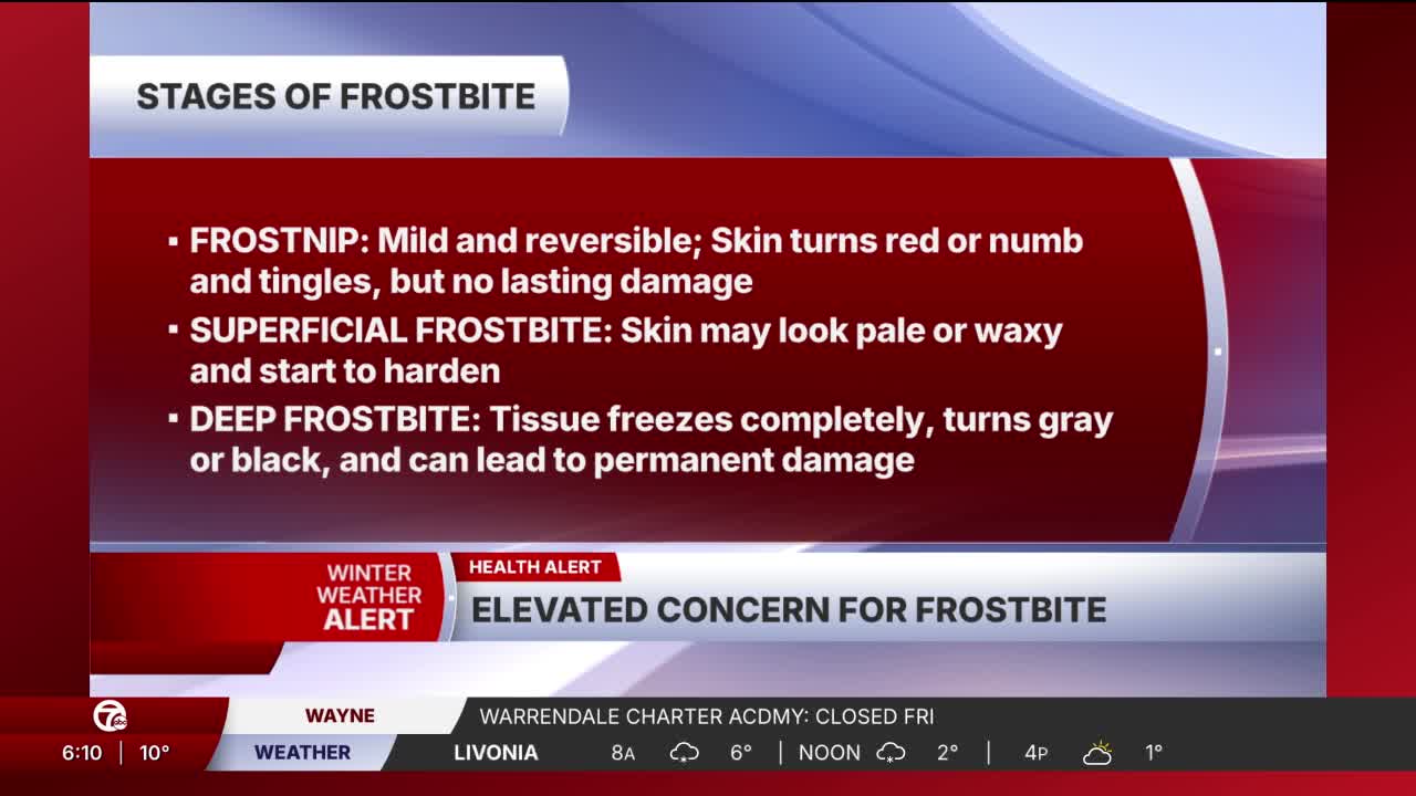 What you need to know about the 3 stages of frostbite