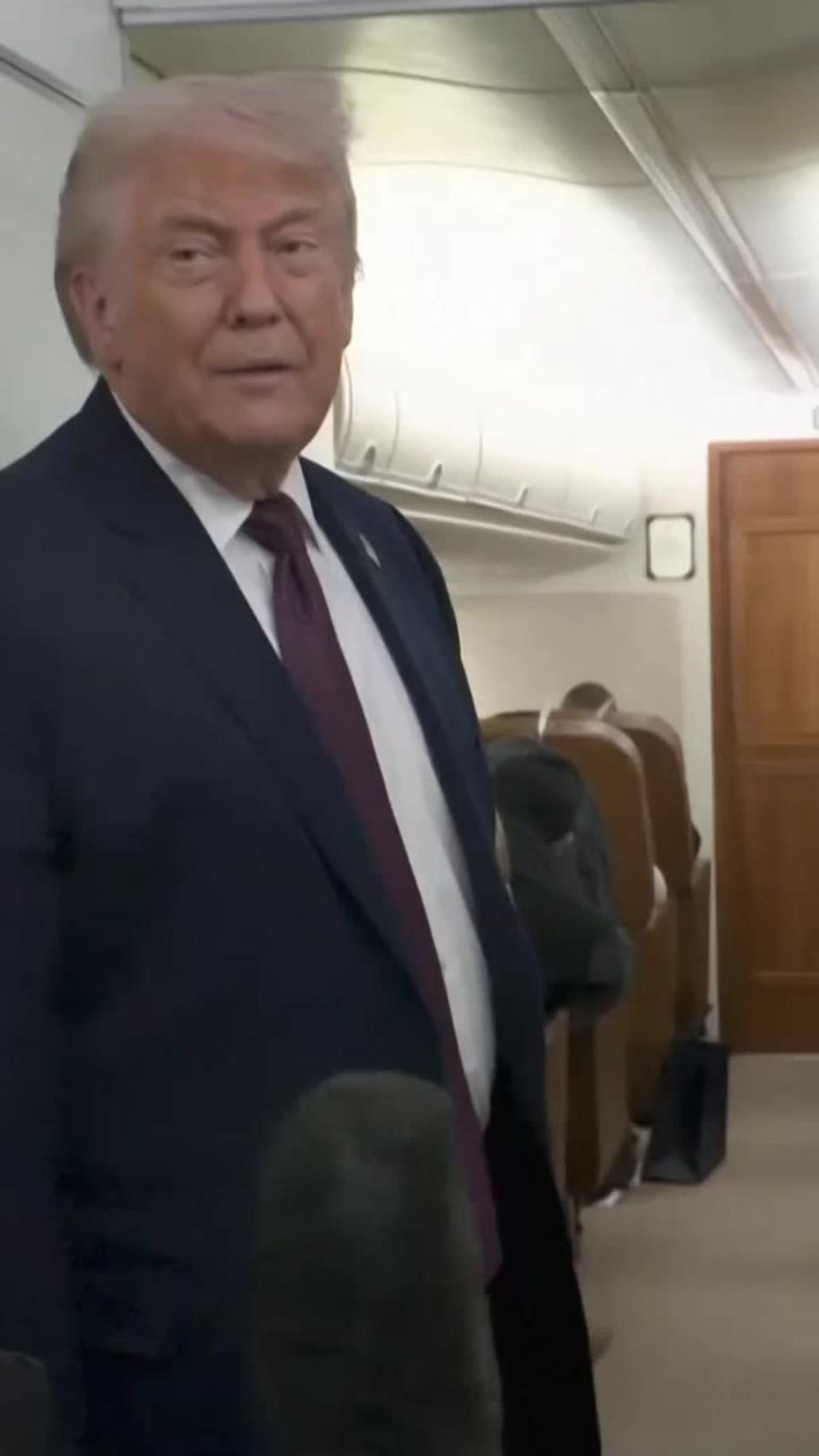 Trump says hand bruising is because he 'clipped it'