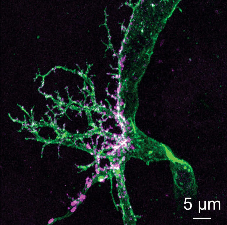 The price of plasticity: Modifiable neurons lose their function with ...