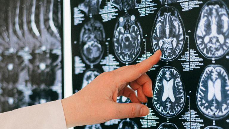 Are your memories fake? New research tackles the Boltzmann brain puzzle