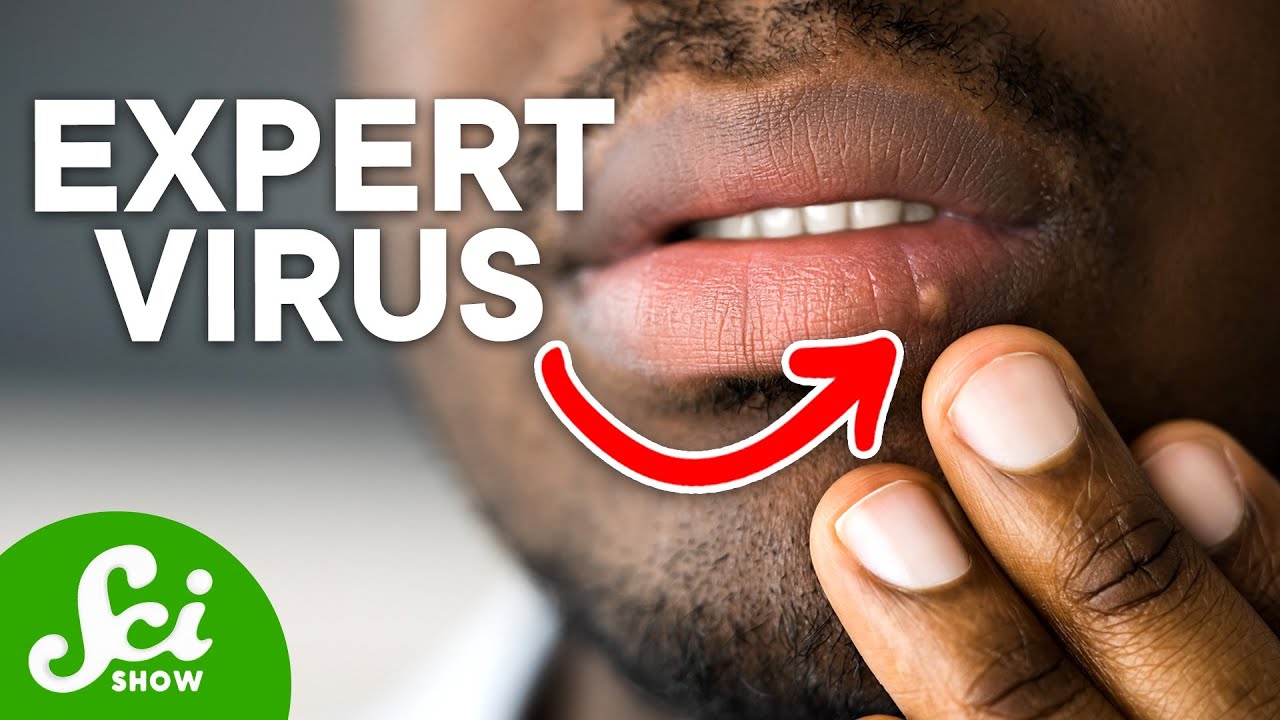 Why herpes is different from other viruses