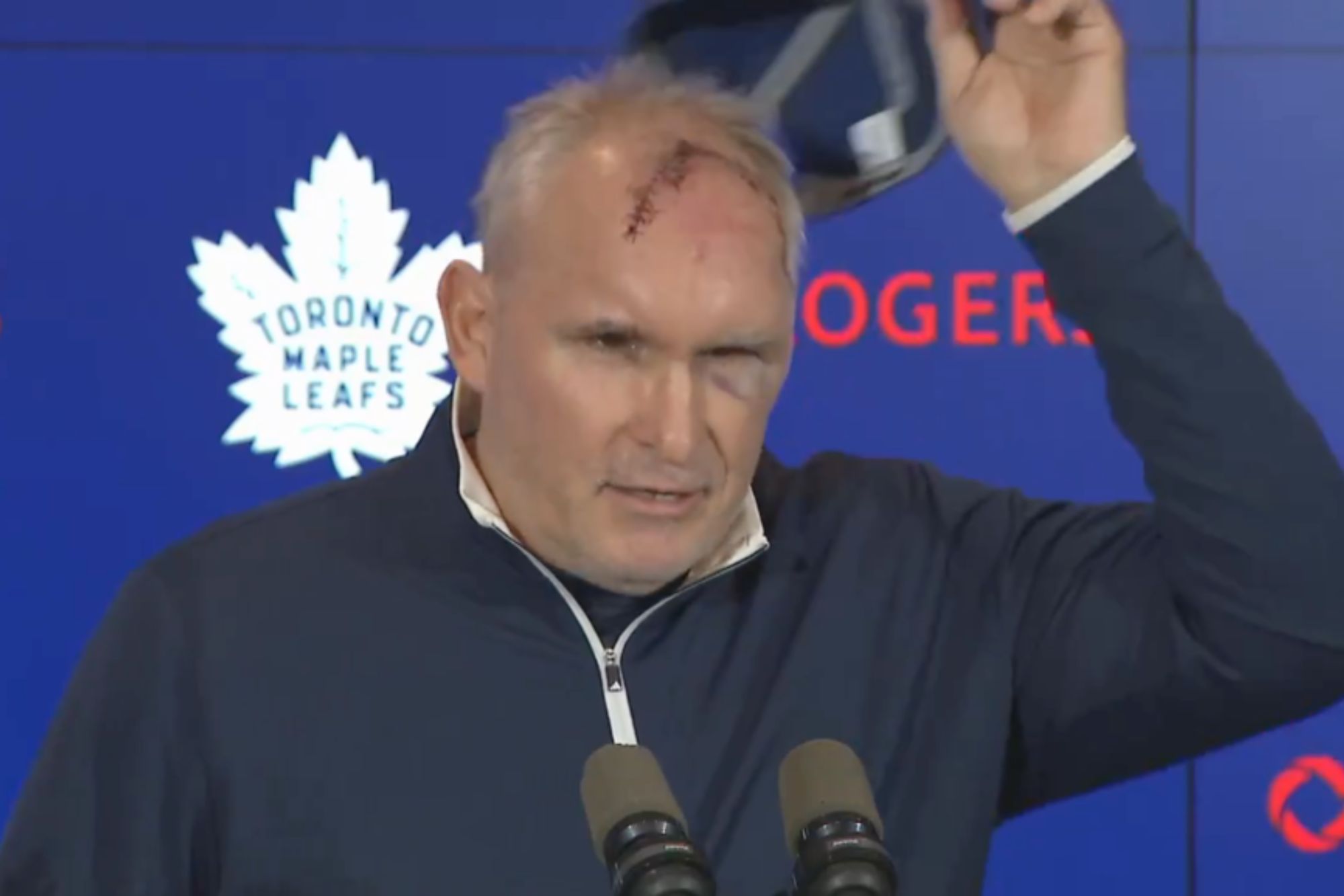 Maple Leafs’ Craig Berube shows off terrifying cut after gym accident