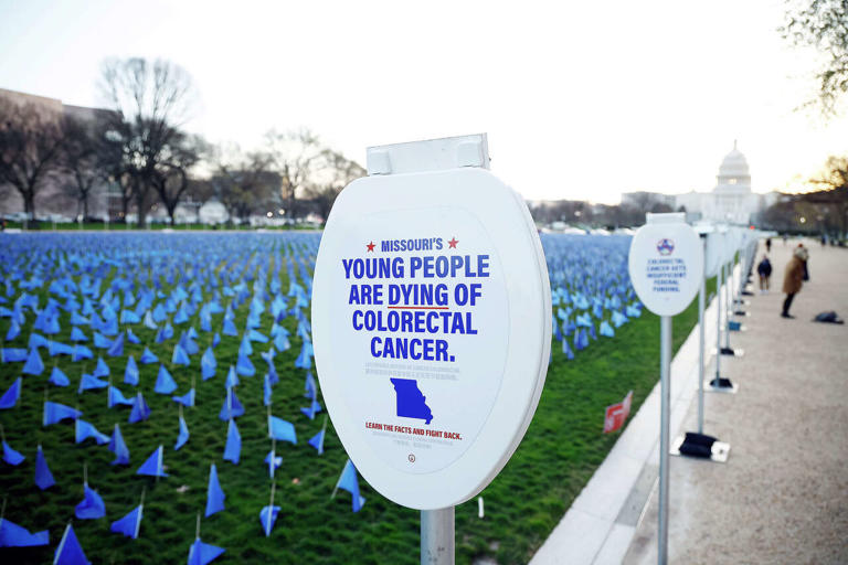 Colon cancer rates are spiking among young people. Here’s why, and how ...