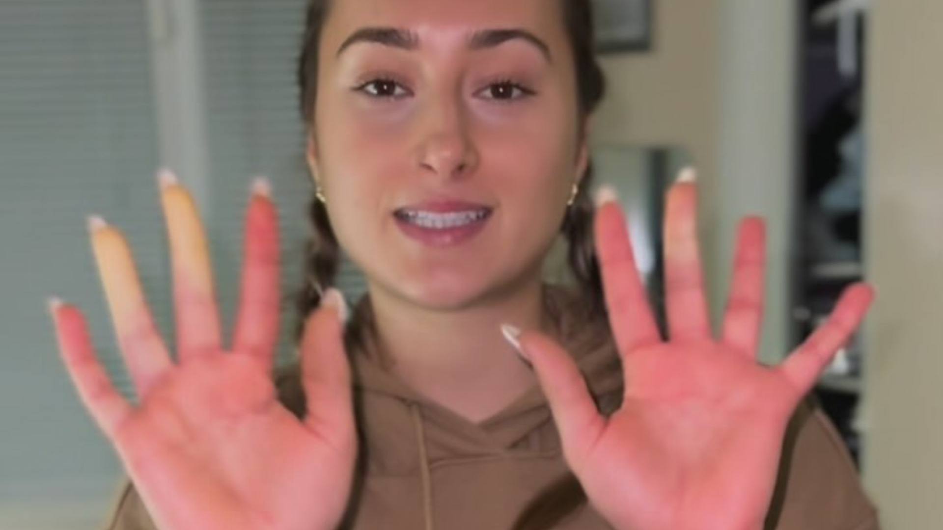 Weiße oder bläuliche Finger im Winter: ein subtiles Anzeichen dieses ...