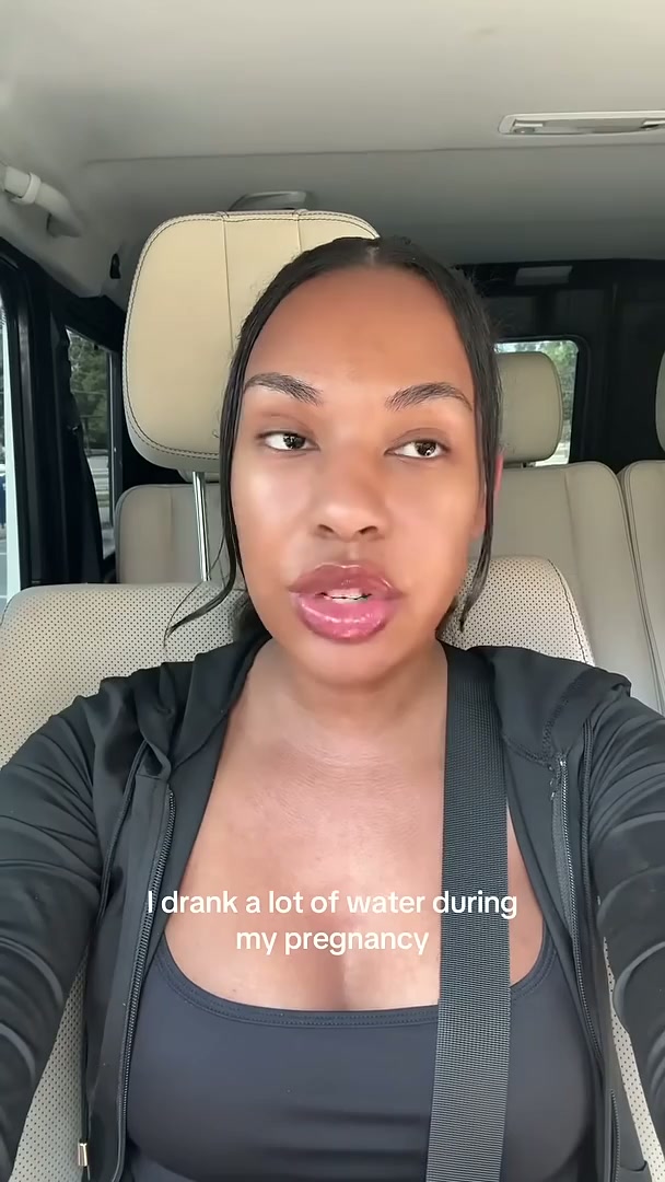 How I Avoided Stretch Marks while Pregnant! 5week postpartum