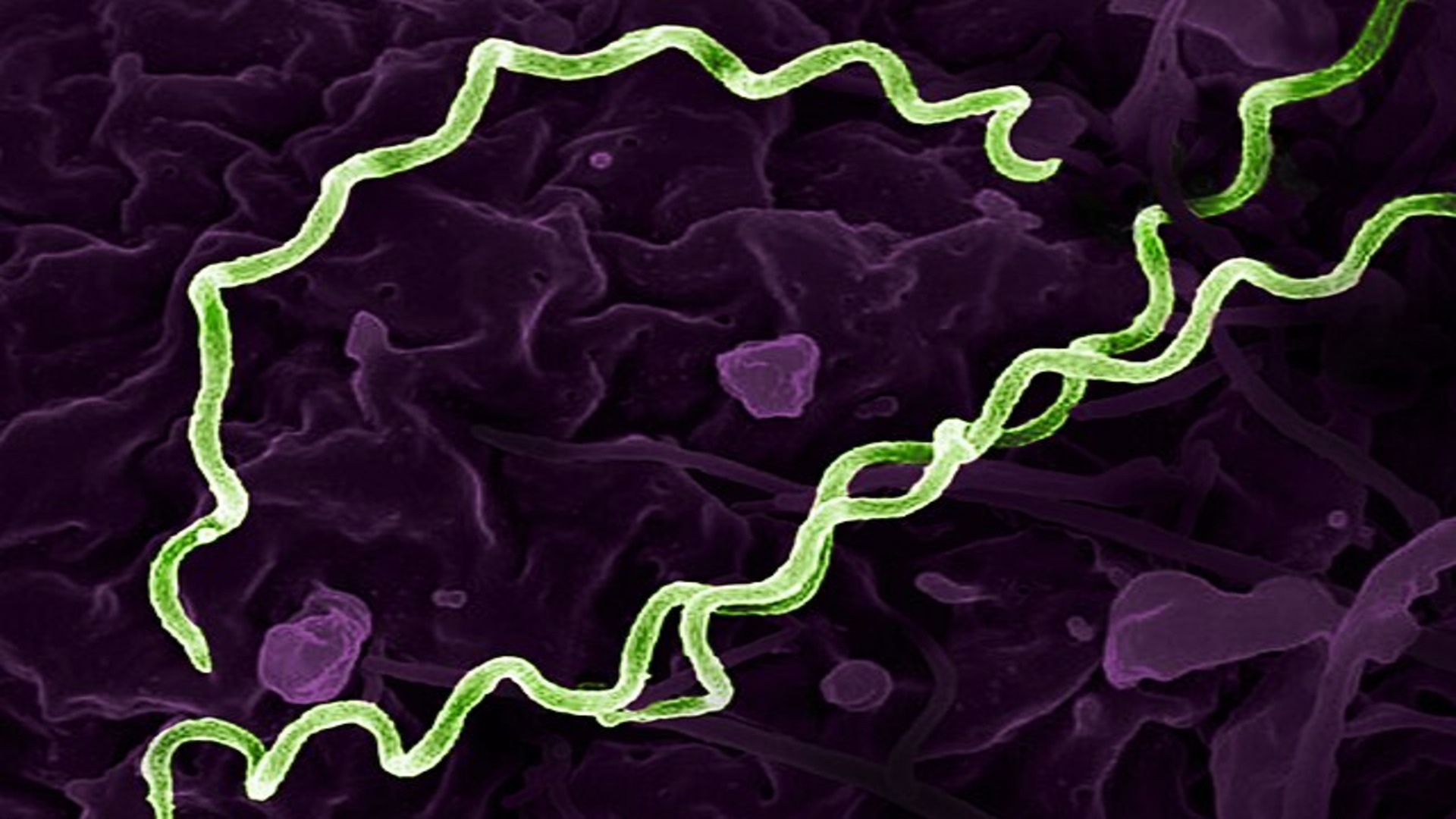 5,550-year-old Colombian man carries world’s oldest syphilis-related ...