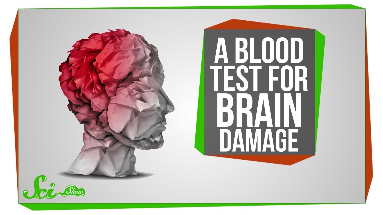 A blood test for brain damage, and AI eye doctors