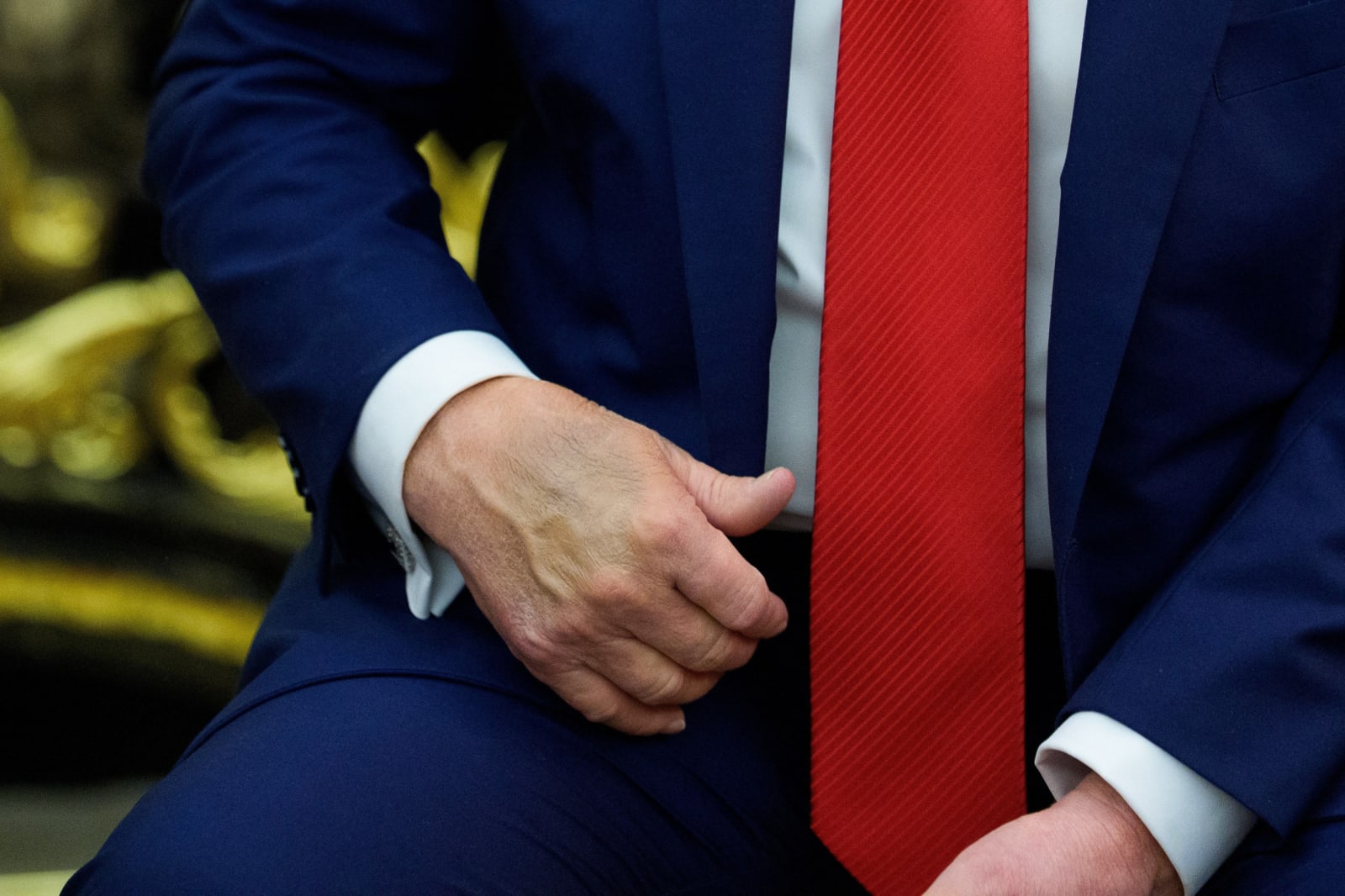 Trump’s bruises compared to Queen Elizabeth’s