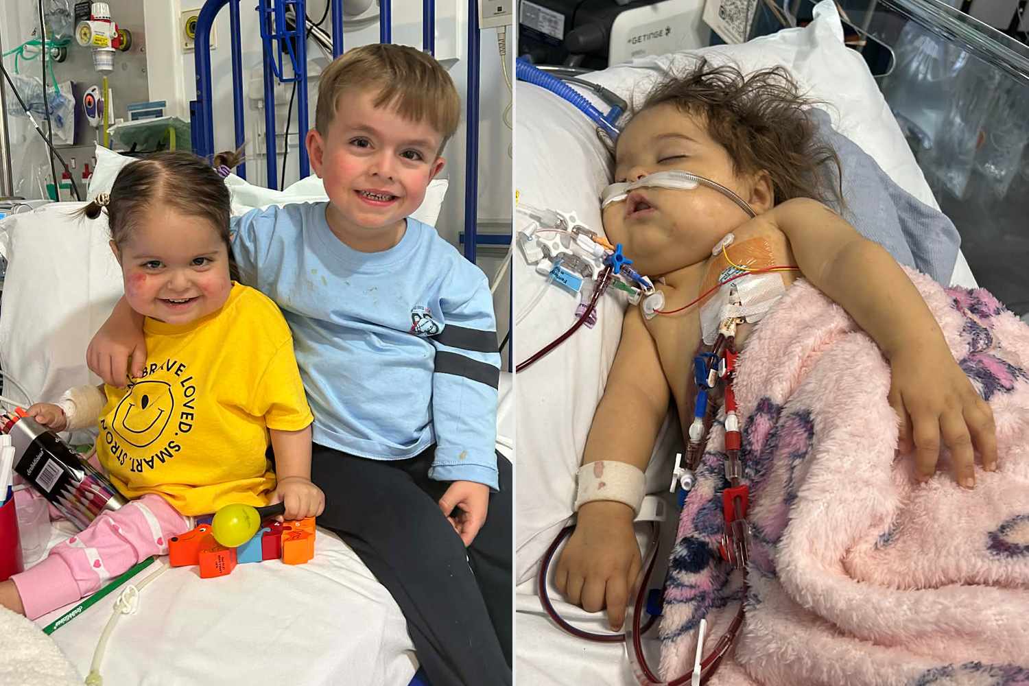 Girl, 3, faces second organ transplant after she and her brother were ...