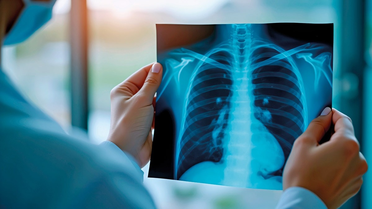 Health watch | India's war on TB: A new, shorter-term cure