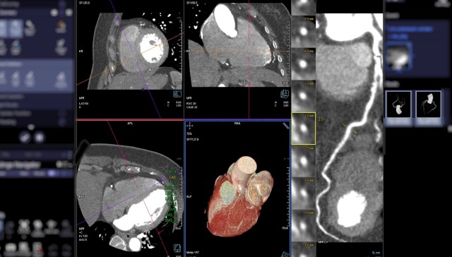 Researchers issue warning after discovering invisible threat that can ...