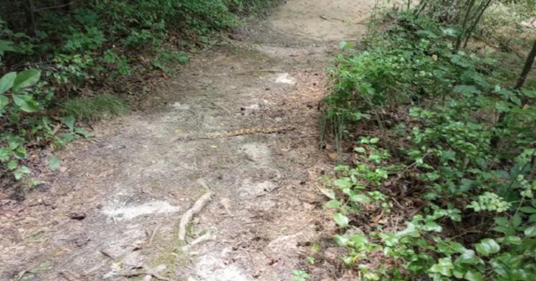 I survived a copperhead snake bite—here's what I learned