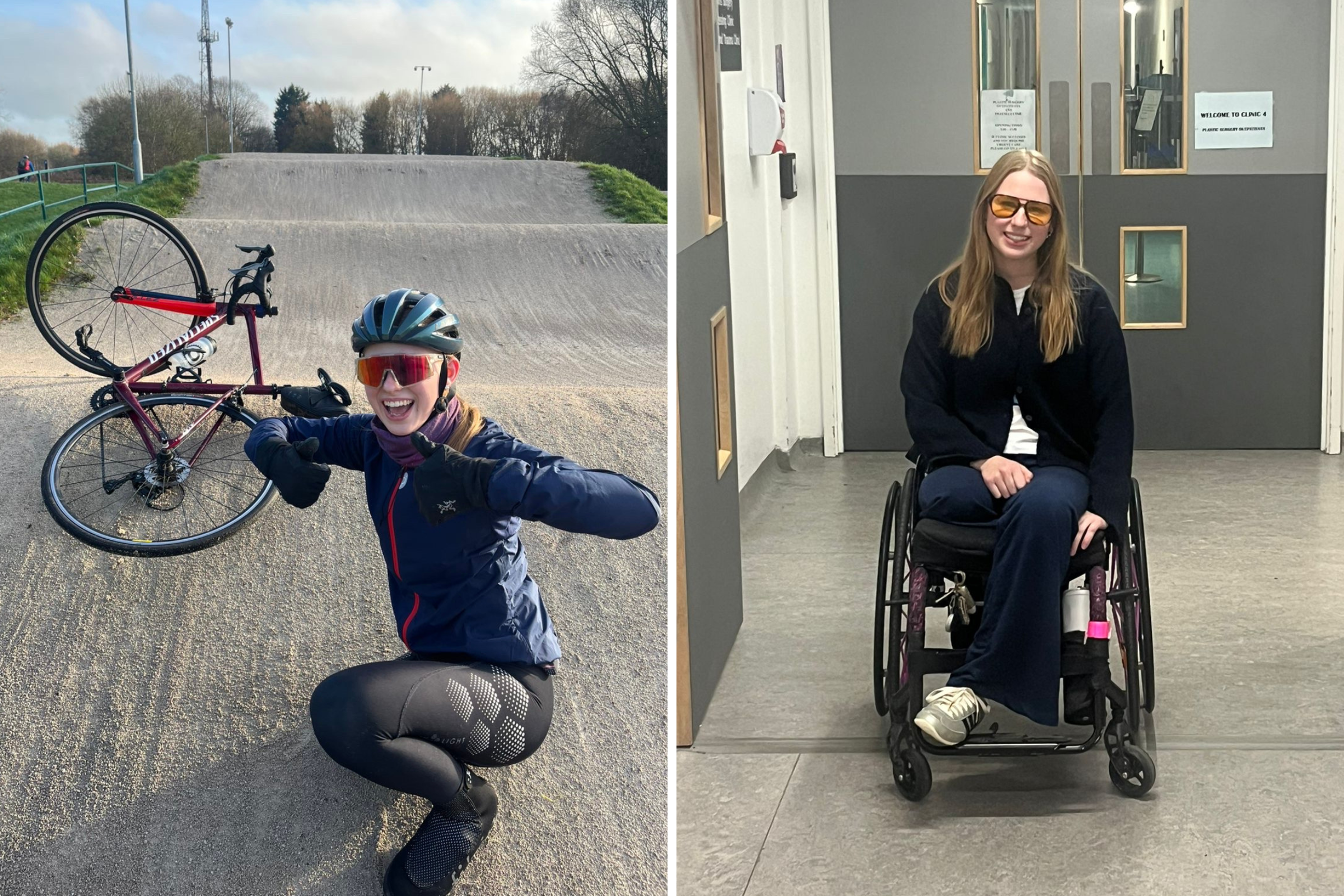 Woman has surgery for varicose veins, shock at why she ended up losing leg