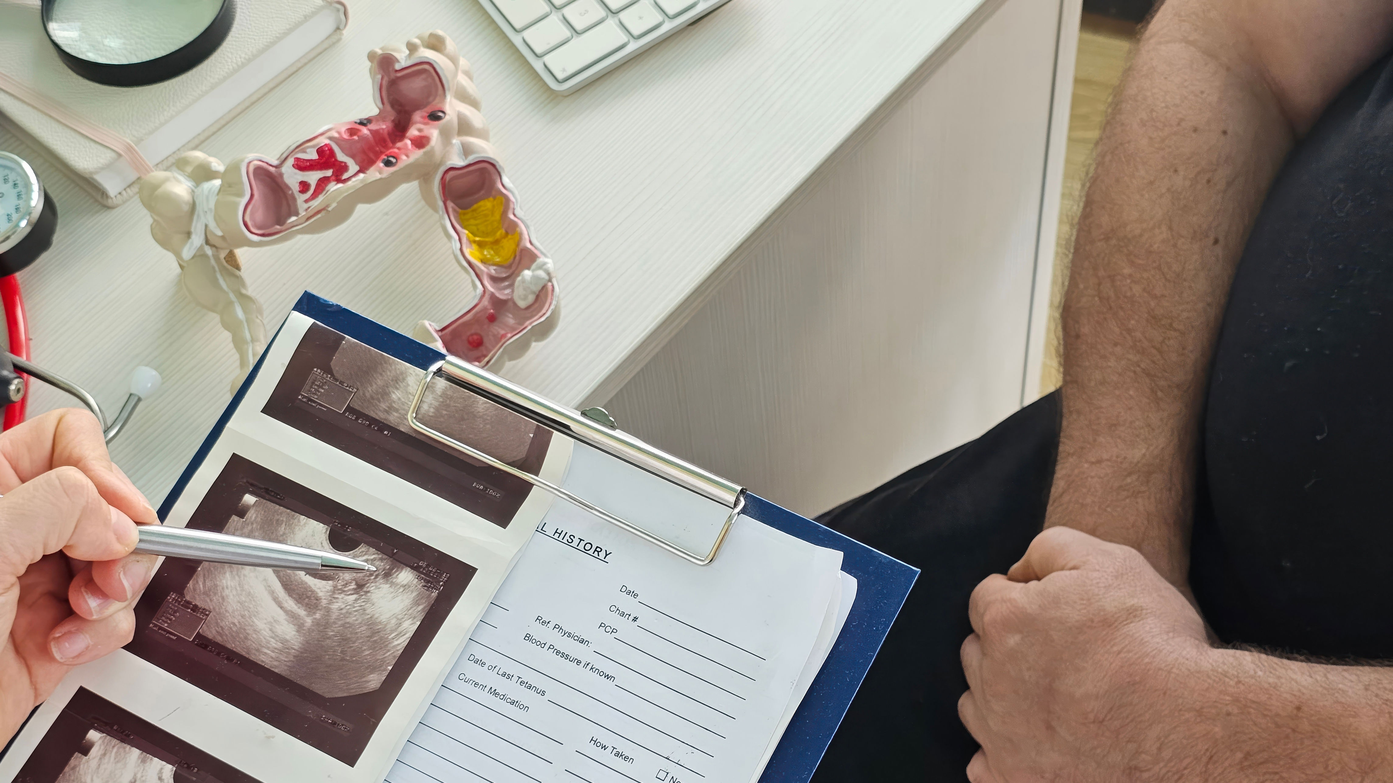 Dlaczego ryzyko raka jelita rośnie z wiekiem? Uczeni odkryli w jelitach ...