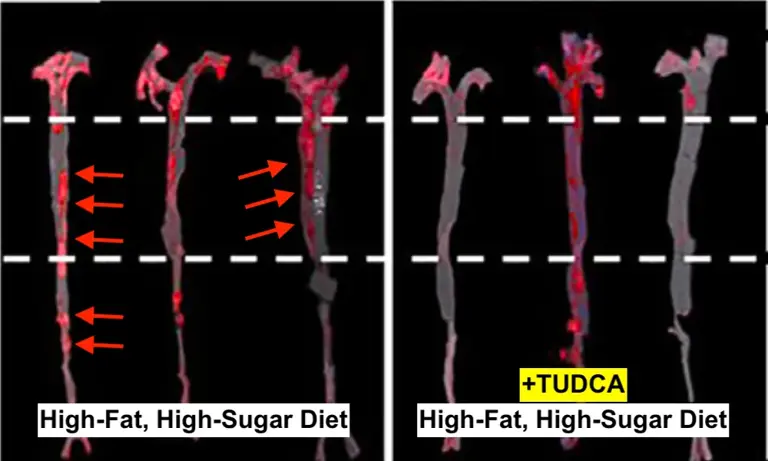 Nattokinase: The heart health supplement on everyone’s tongue