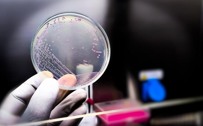 AI designs virus to attack deadly E coli bacteria