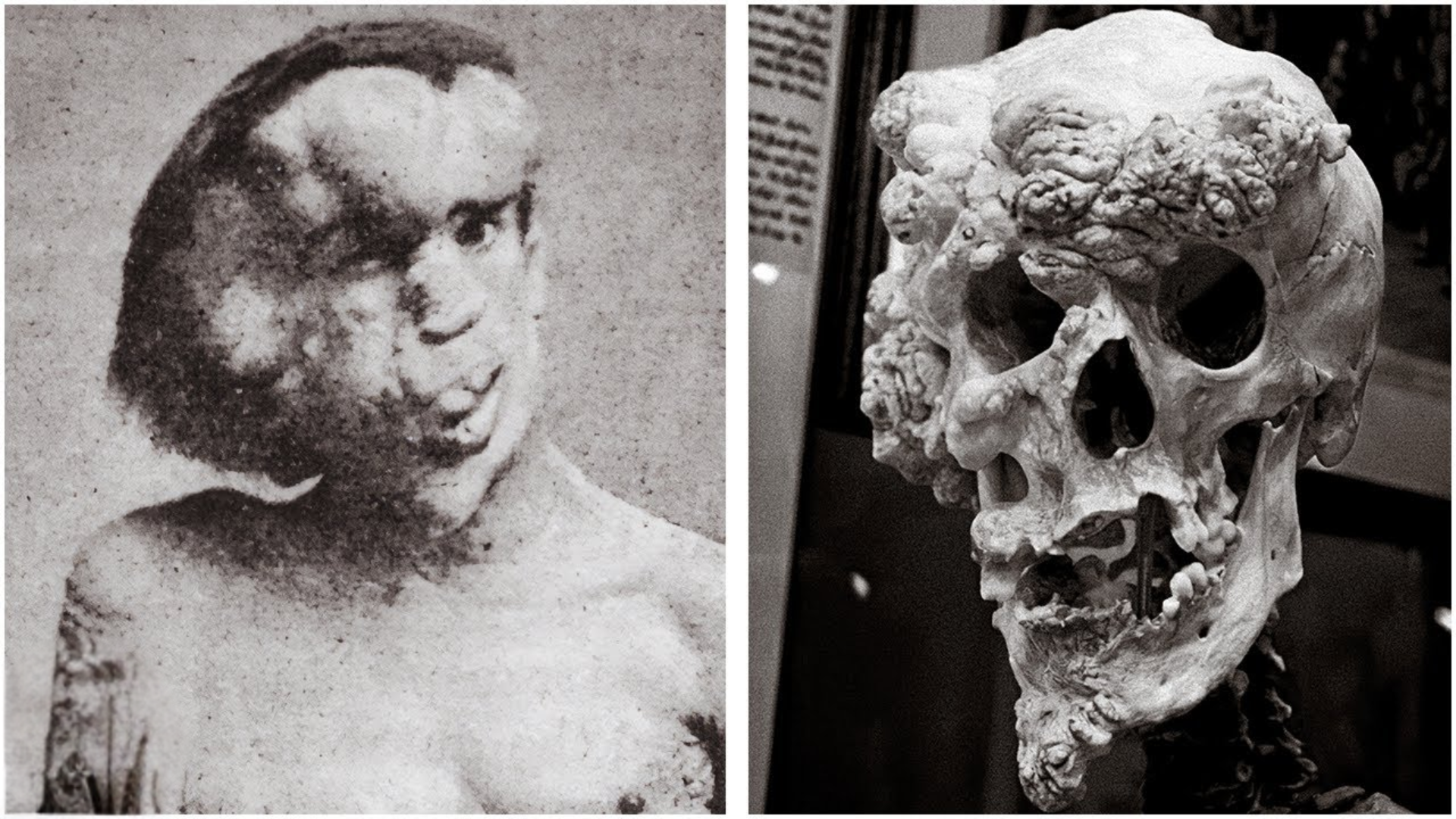 The weird and true story of the Elephant Man