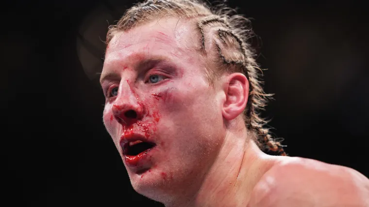 Paddy Pimblett next fight: 'Paddy the Baddy' options after UFC 324 loss ...