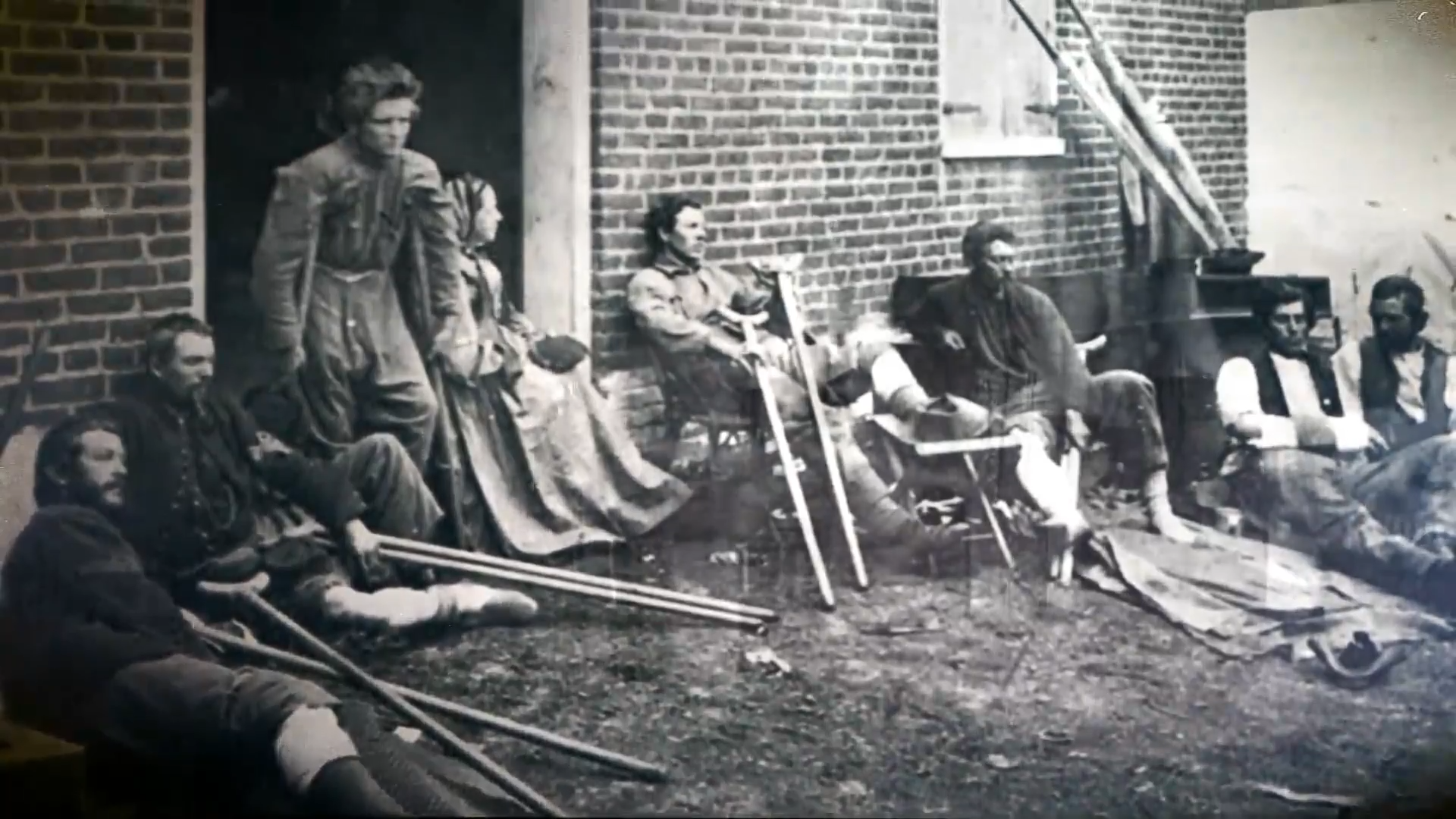 The Civil War soldier who was shot through the head and lived