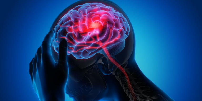 How to spot a stroke before it is too late