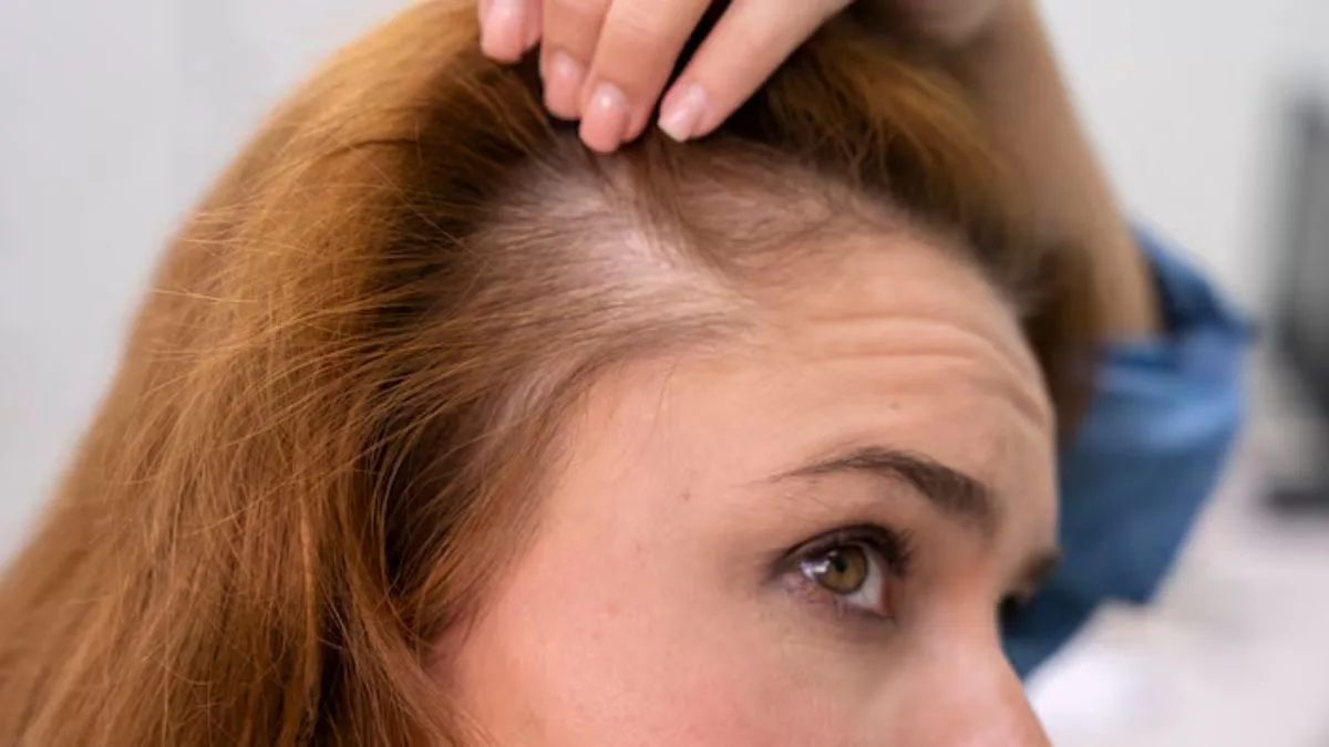 Hair fall drama is real! Acharya Balkrishna’s aloe vera secret is ...