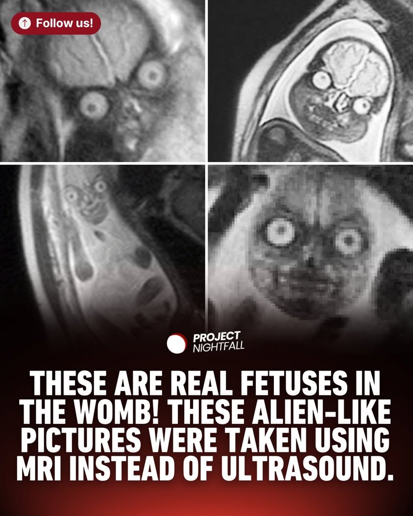 These are actual MRI scans of human fetuses in the womb, confirmed by ...
