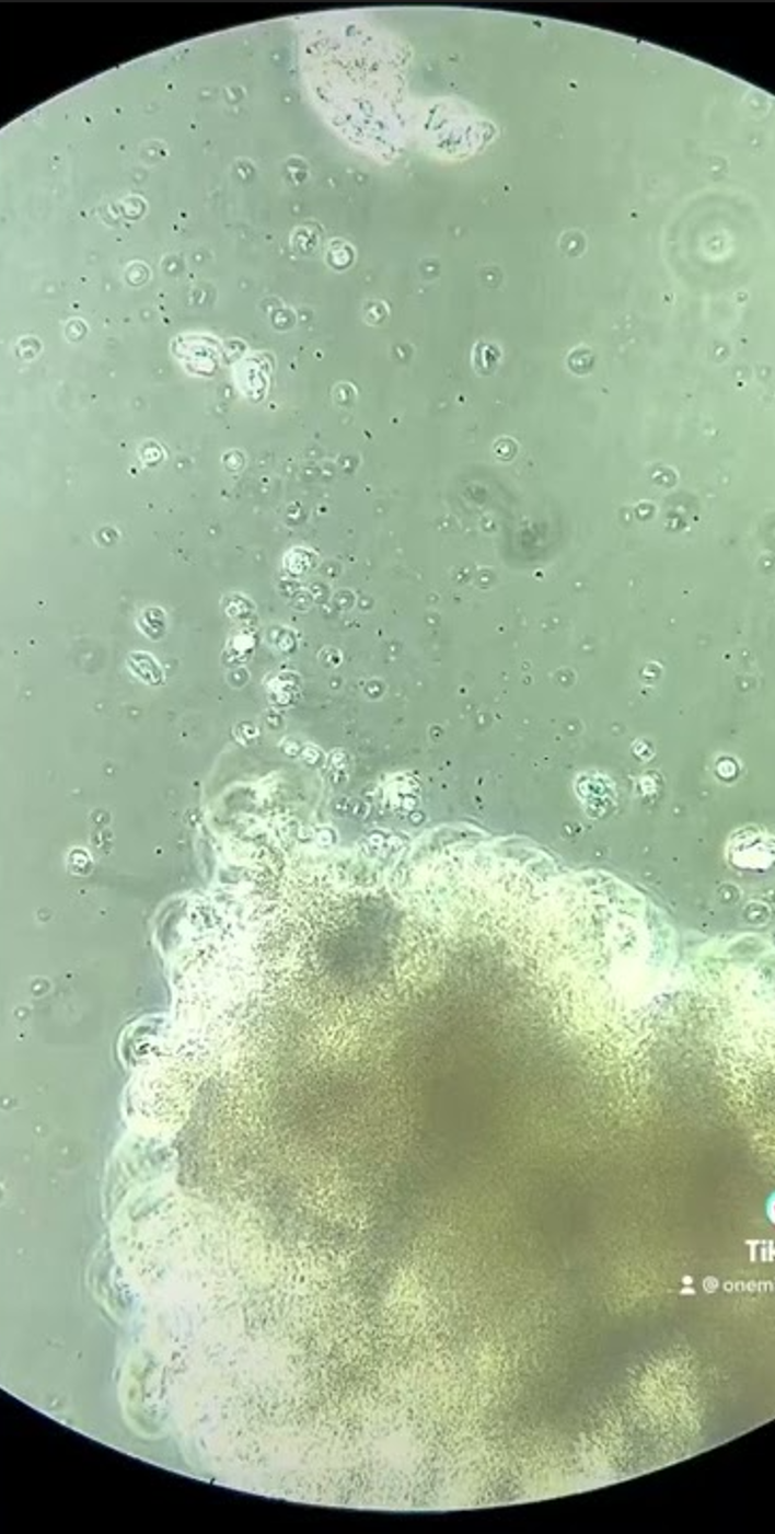 Bedside water under the microscope!