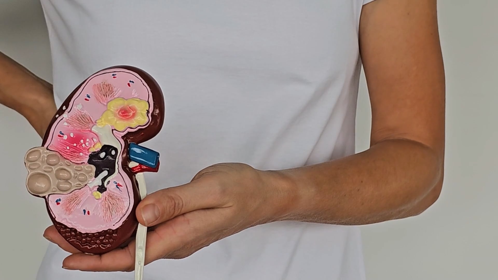 9 out of 10 people that have this silent disease don't know it