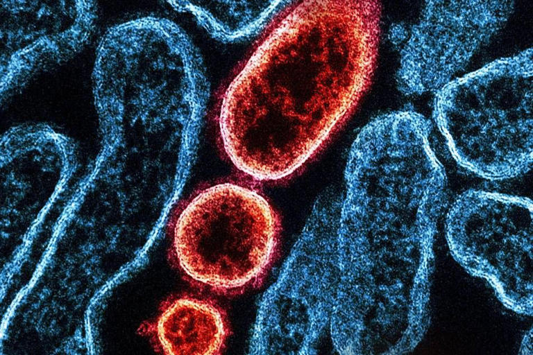 What is the Nipah virus outbreak in India, and why is it taken seriously?