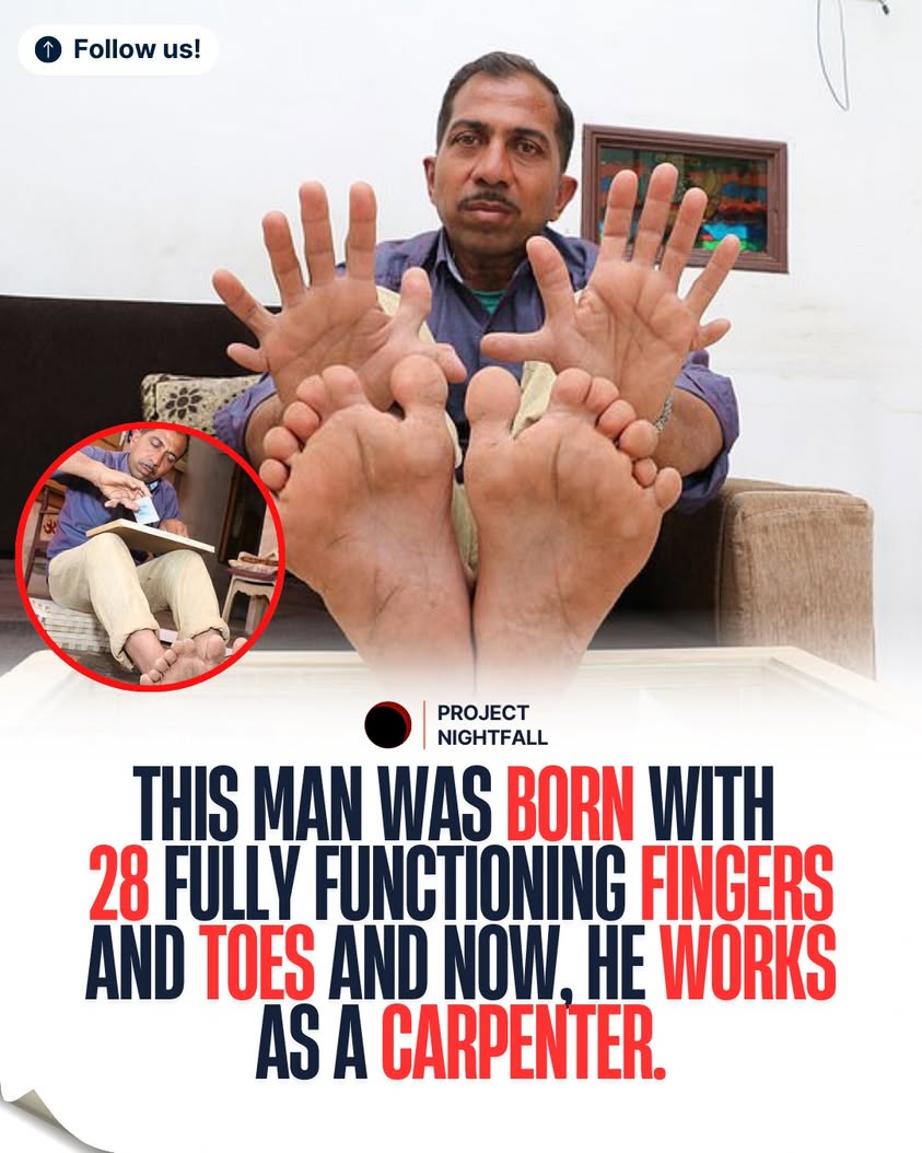 Imagine being born different and turning it into your superpower ...