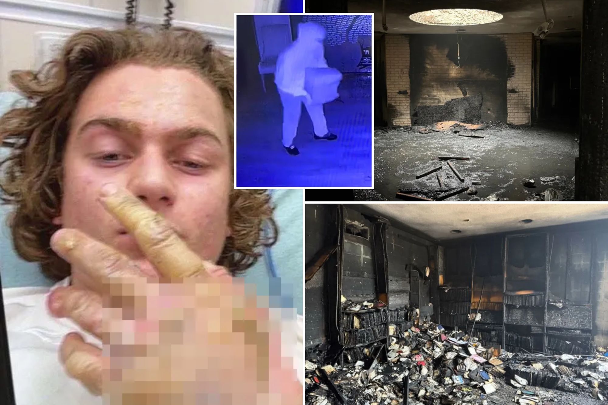 Teen accused of torching Mississippi synagogue posted gruesome selfie ...