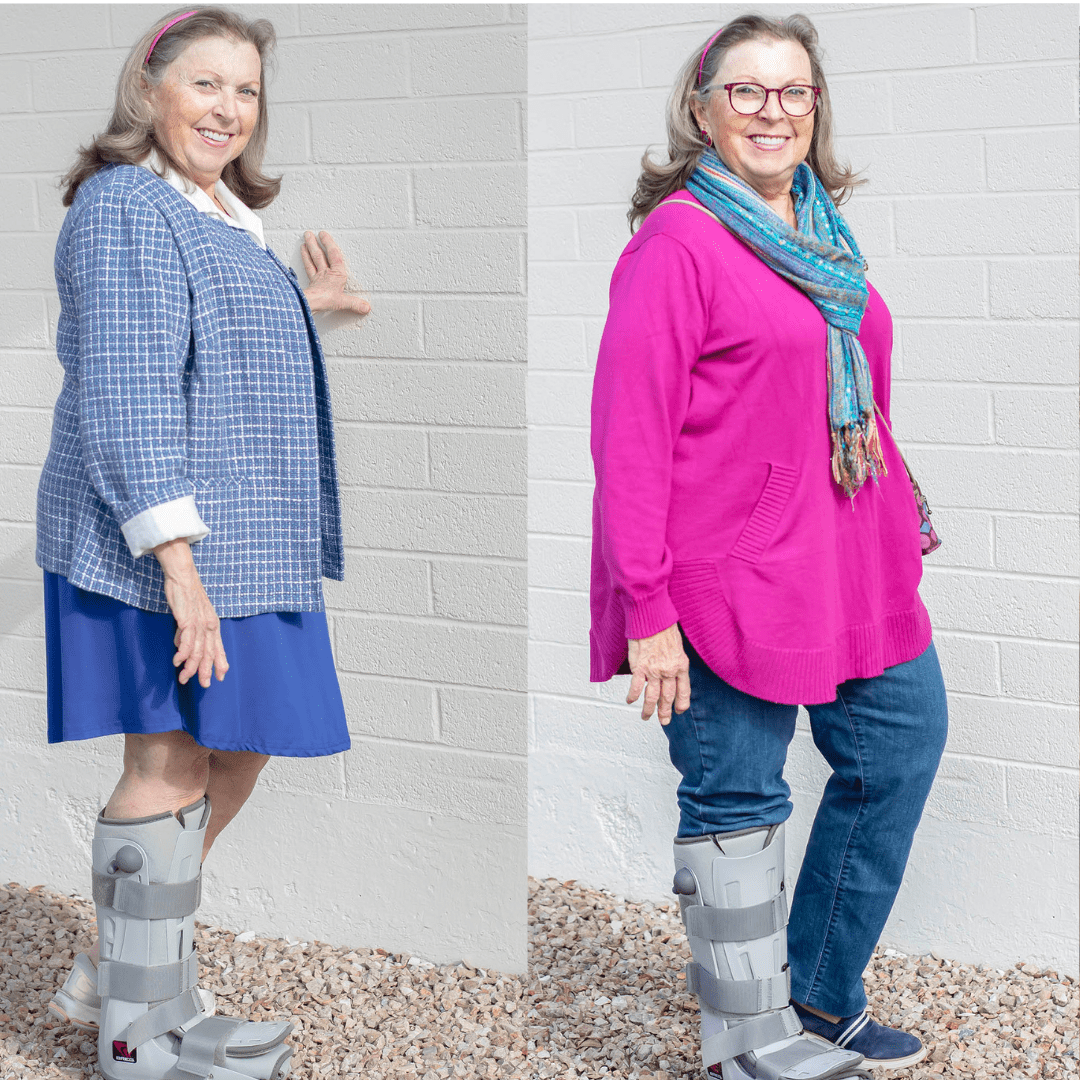 Real life lessons for looking stylish with a walking boot