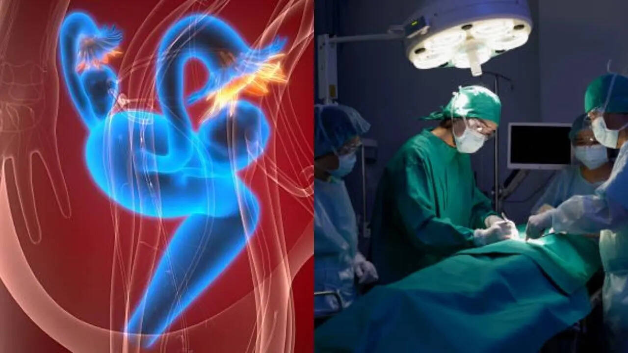 Lucknow doctors perform rare surgery on woman born with two uteruses ...