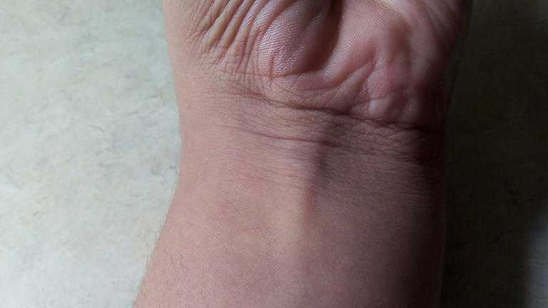 There’s a tendon in your arm that’s disappearing in modern humans—and ...