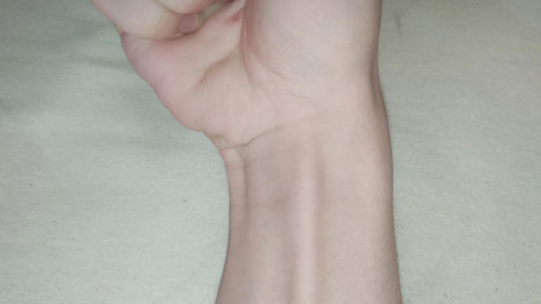 There's a tendon in your arm that's disappearing in modern humans—and ...