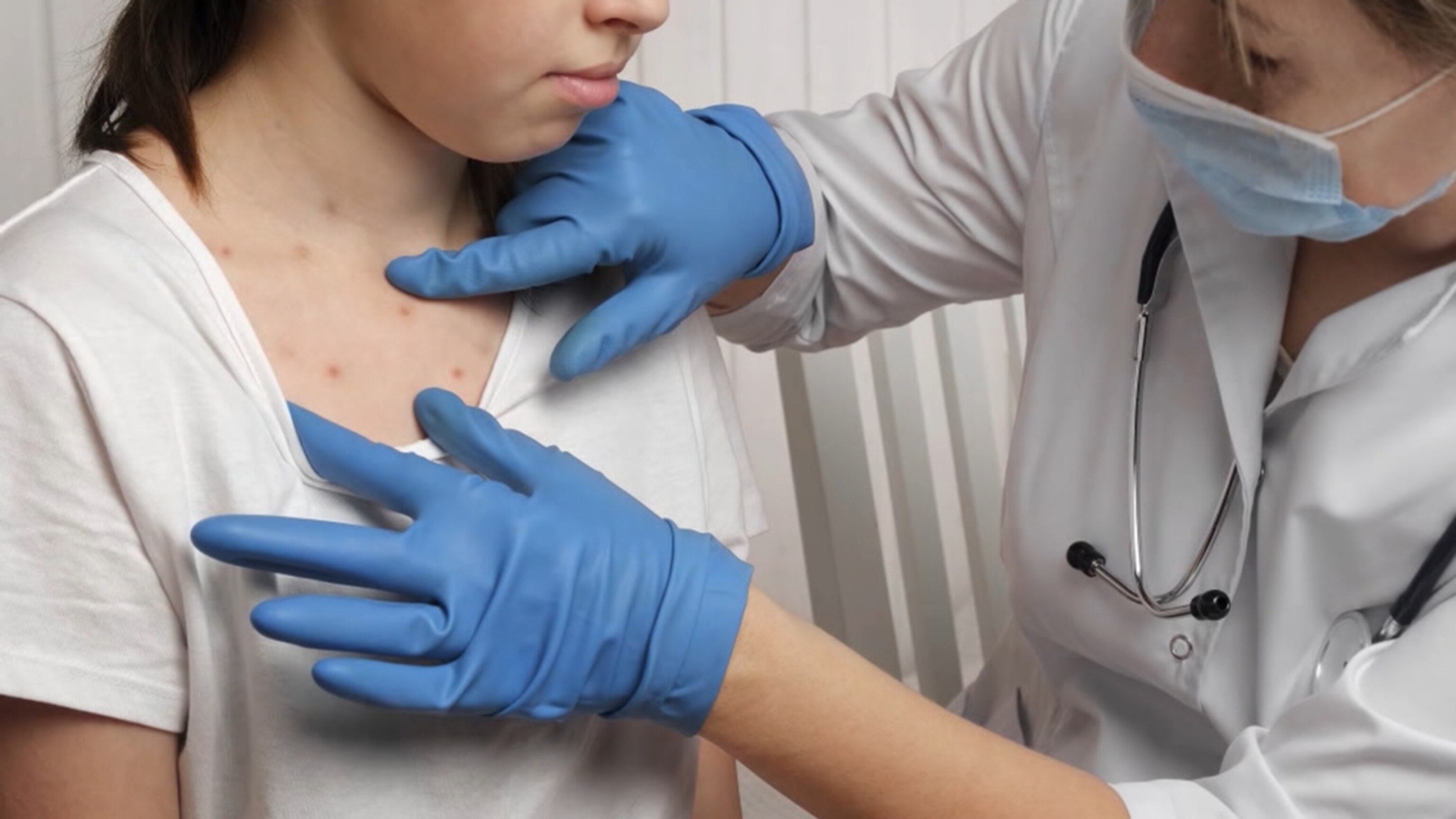 Measles outbreak growing in South Carolina