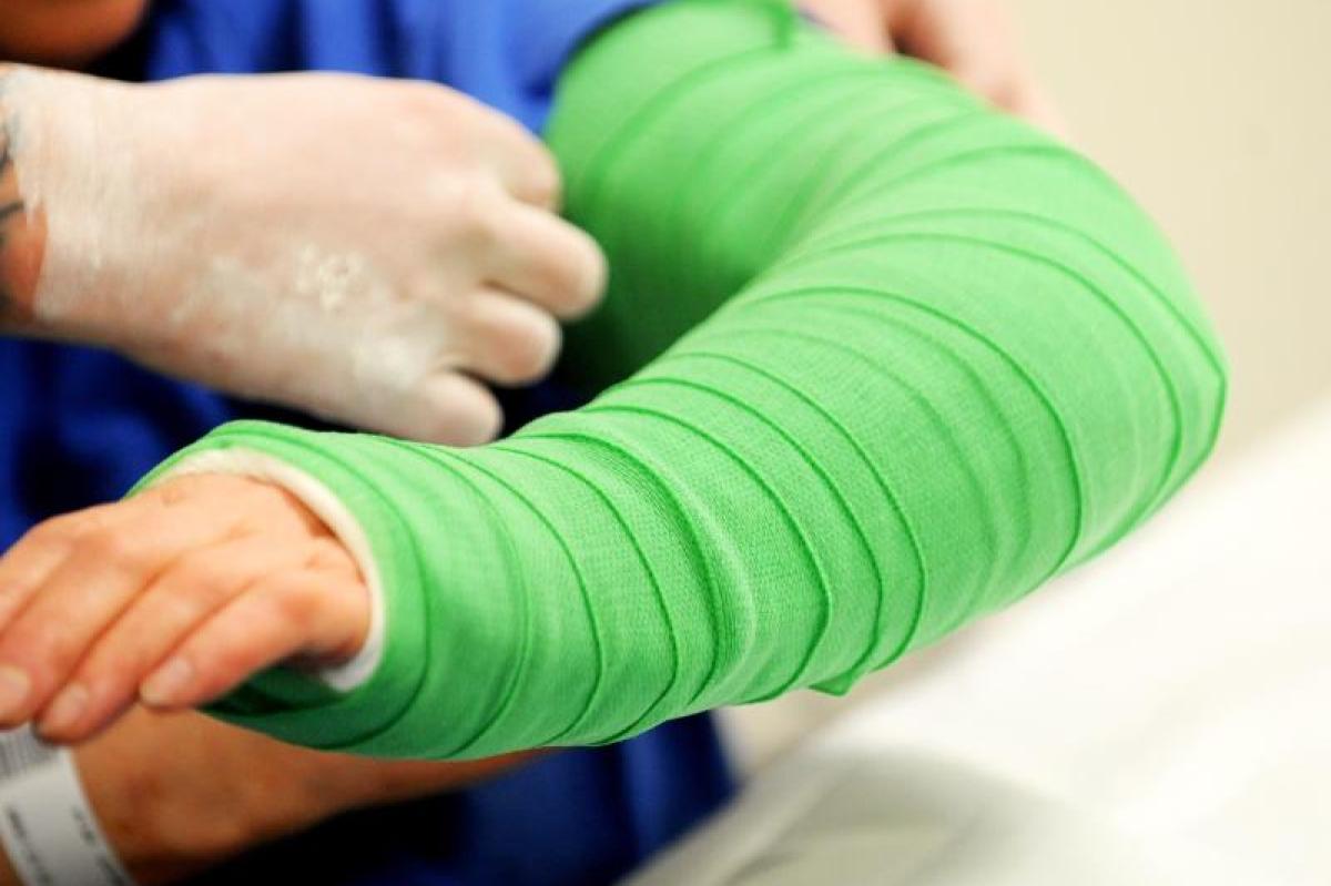 Gips oder Schiene: Darf man mit Gipsarm Auto fahren?