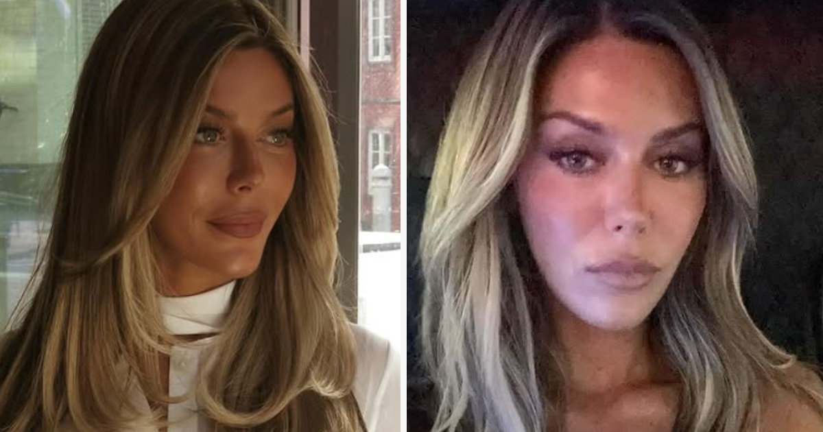 Bianca Ingrosso avslöjar nya skönhetsingreppet i ansiktet