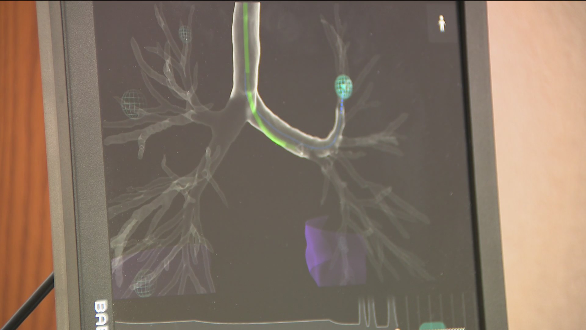 Governor Reynolds addresses Iowa cancer rates in Condition of the State